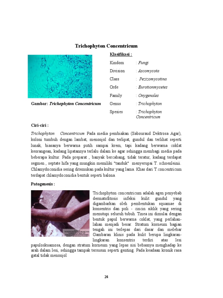 Trichophyton Concentricum Miko Fitto BLKG | PDF