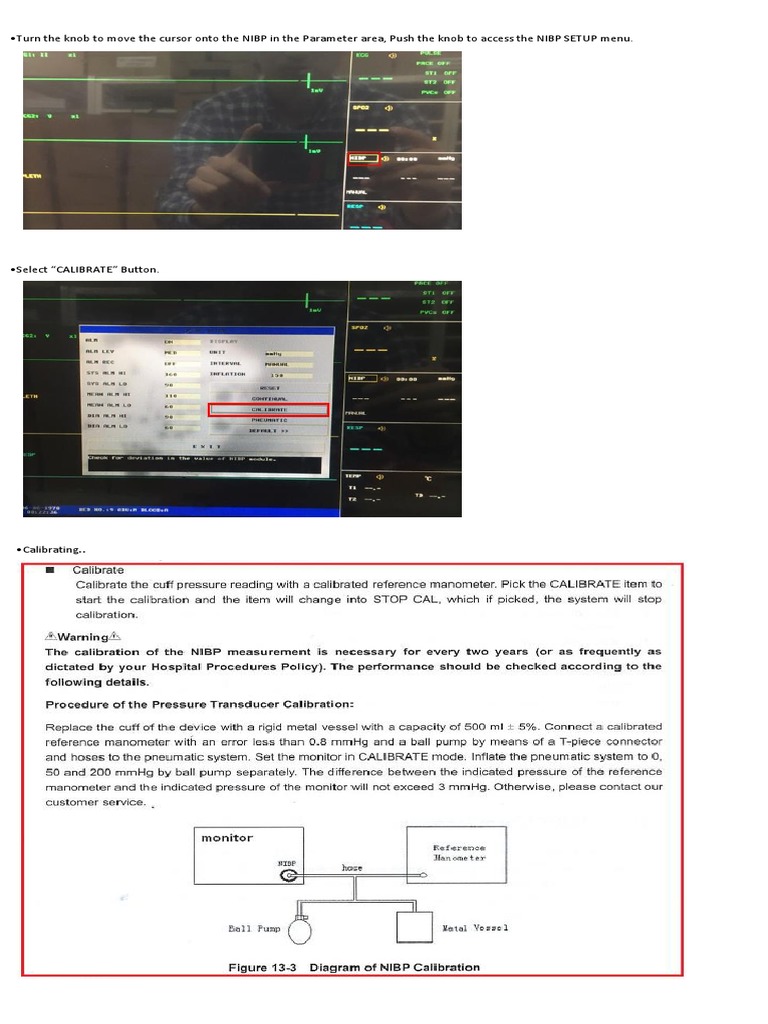 NIBP Calibration | PDF
