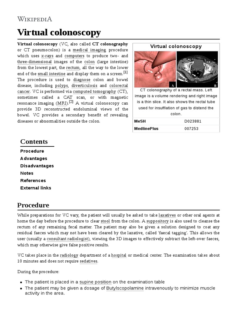 Virtual Colonoscopy (VC, Also Called CT Colonography | PDF ...