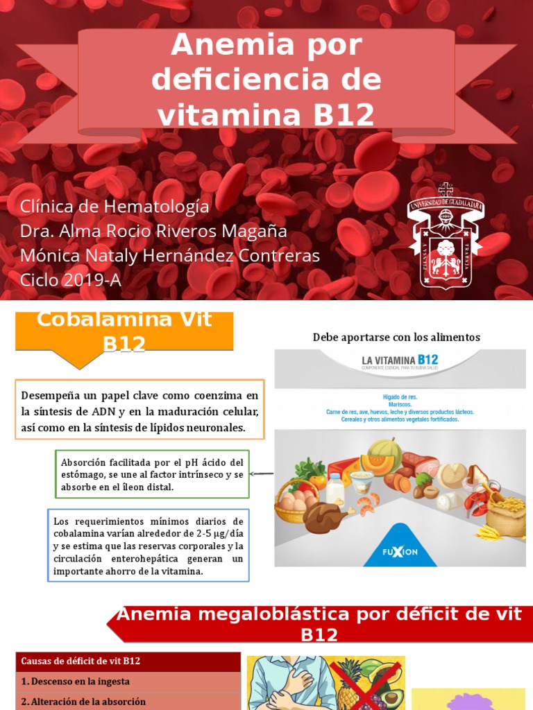 Anemia megaloblástica por deficiencia de vitamina B12 | PDF | Vitamina ...