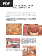 La Línea de Fulcro | PDF | Dentadura postiza | Naturaleza