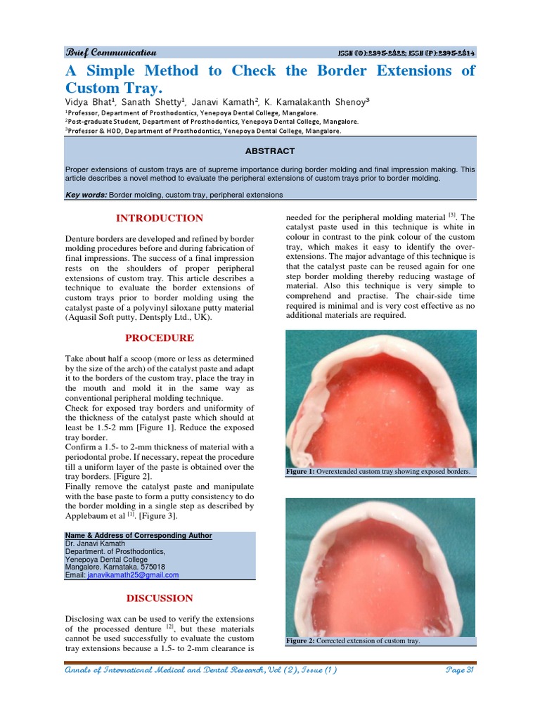 A Simple Method To Check The Border Extensions of Custom Tray | PDF ...