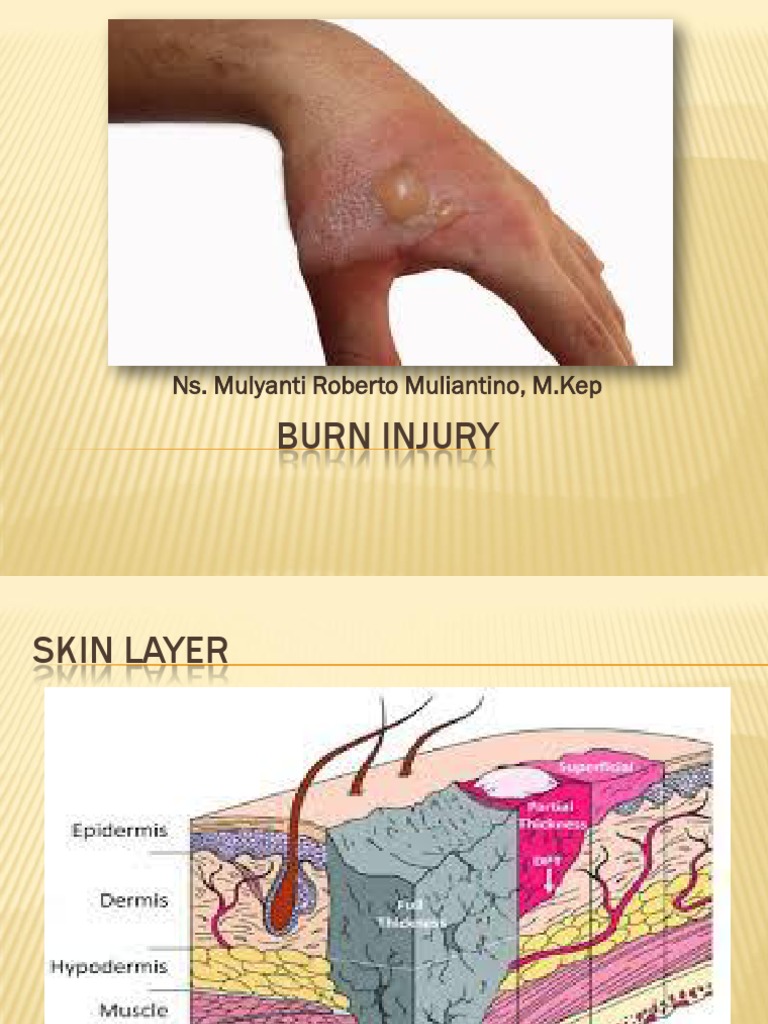 Burn Injury PDF | PDF | Burn | Intravenous Therapy