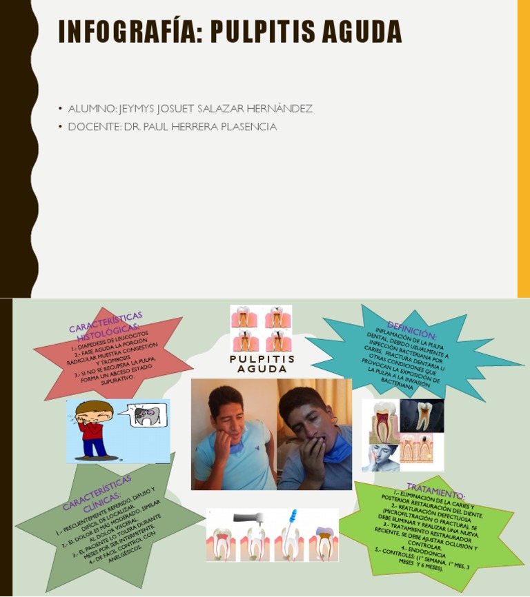 Infografía Pulpitis Aguda | PDF