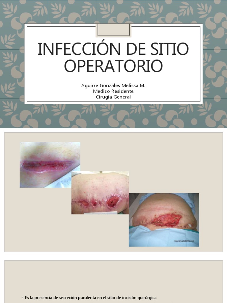 Infeccin de Sitio Operatorio 170324203552 | PDF | Staphylococcus Aureus | Cirugía