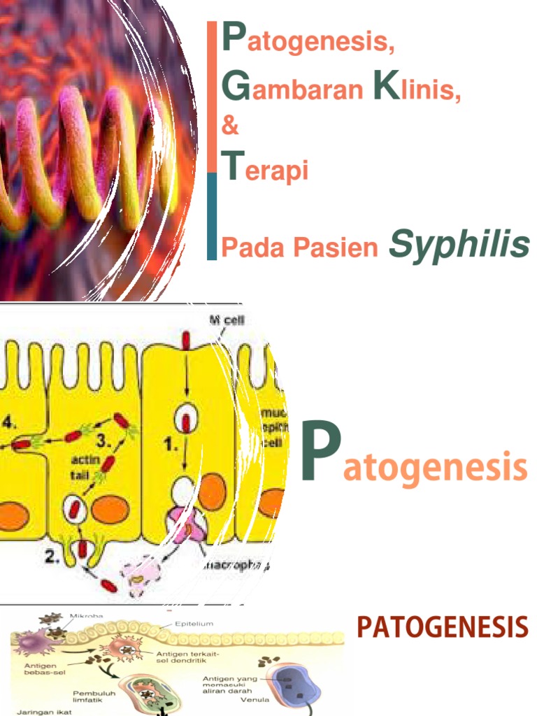 An Overview of the Pathogenesis, Clinical Manifestations, and Treatment ...