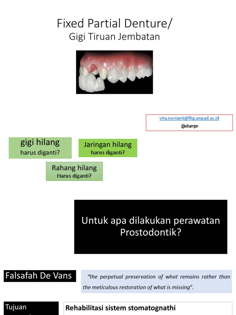 Gigi Tiruan Jembatan (Fixed Partial Denture) PDF