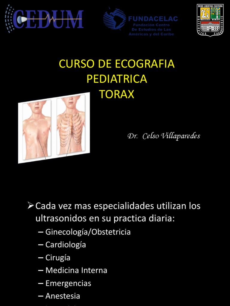 Ecografia Pediatrica de Torax | PDF | Pulmón | Neoplasias
