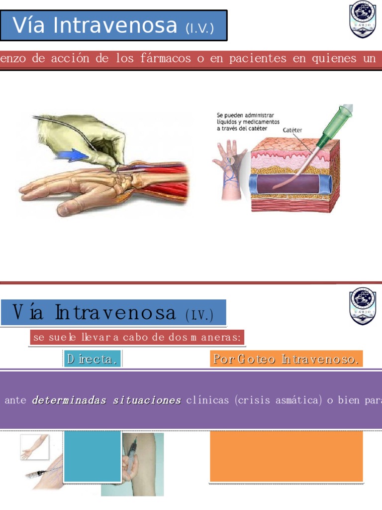 Vía Intravenosa | Terapia intravenosa | Medicamentos con receta