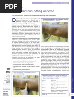 Pitting Edema Grading Scale | PDF | Nature
