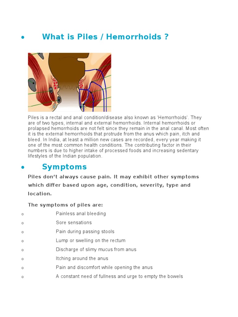 What Is Piles? | PDF | Hemorrhoid | Gastroenterology