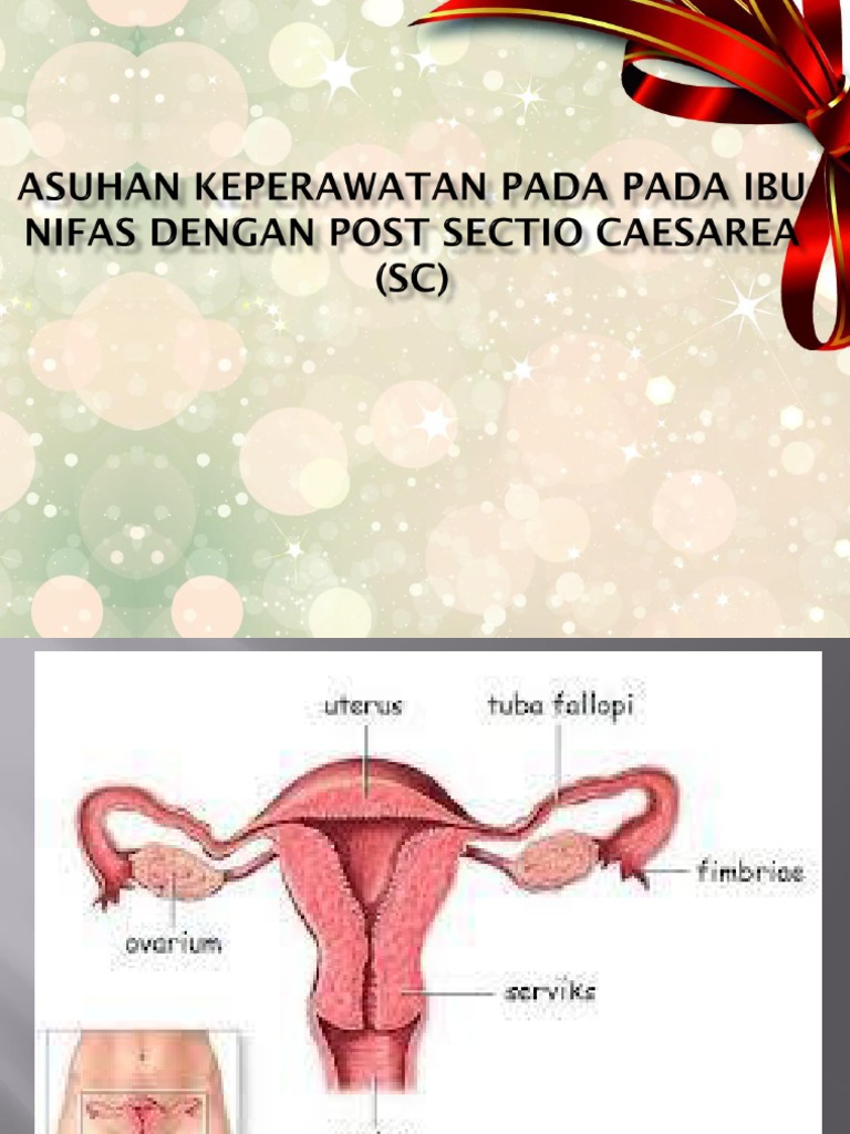 KOMPLIKASI SECTIO CAESAREA | PDF
