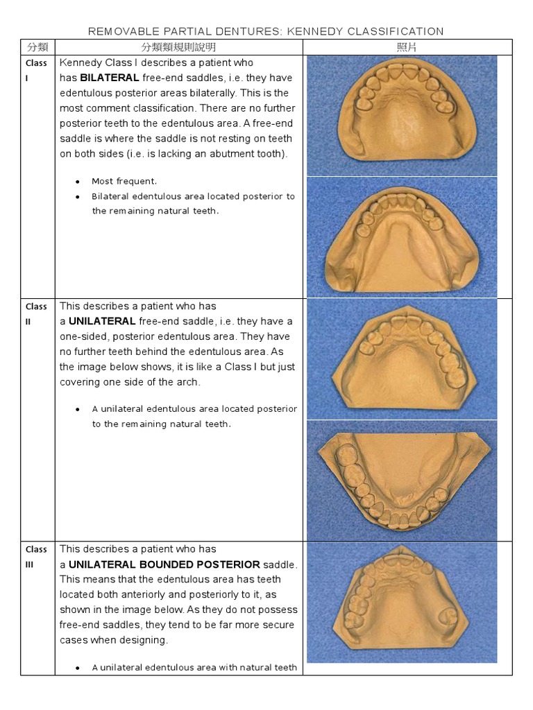 Removable Partial Dentures PDF | PDF | Face | Human Head And Neck