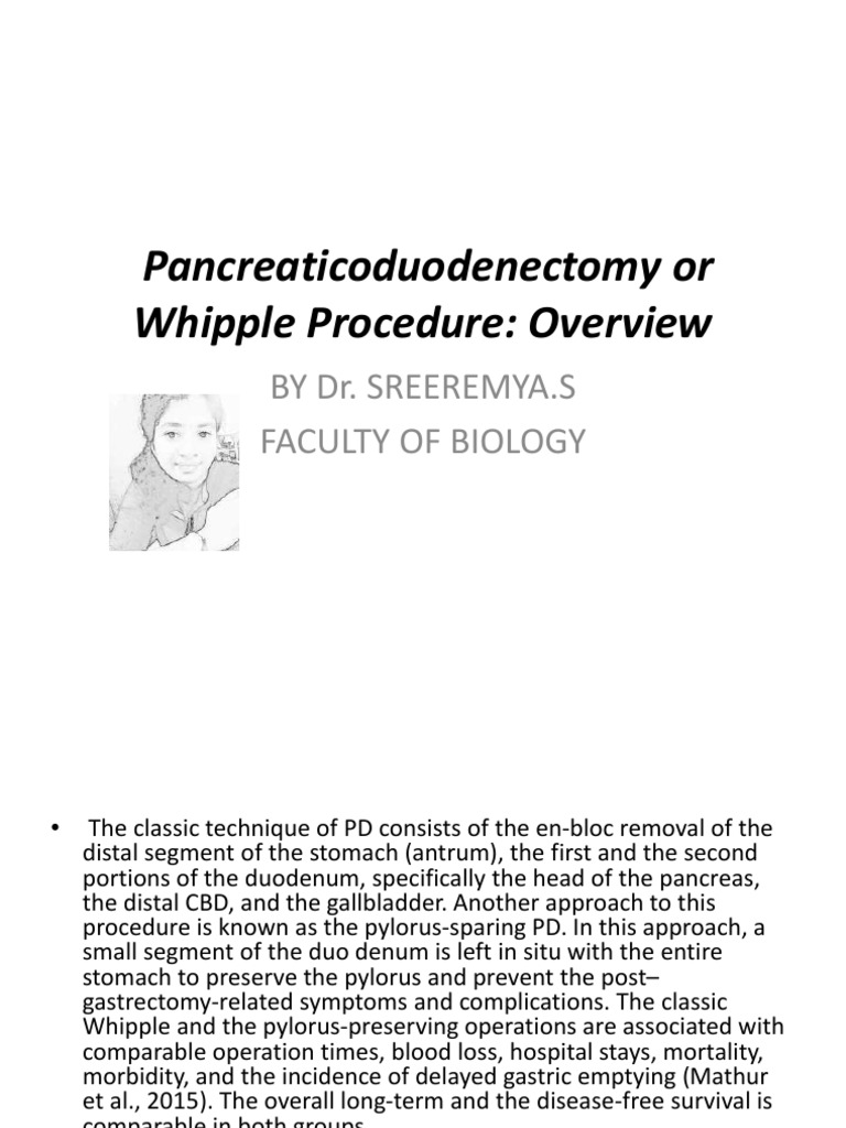 Pancreaticoduodenectomy or Whipple Procedure: Overview: by Dr ...