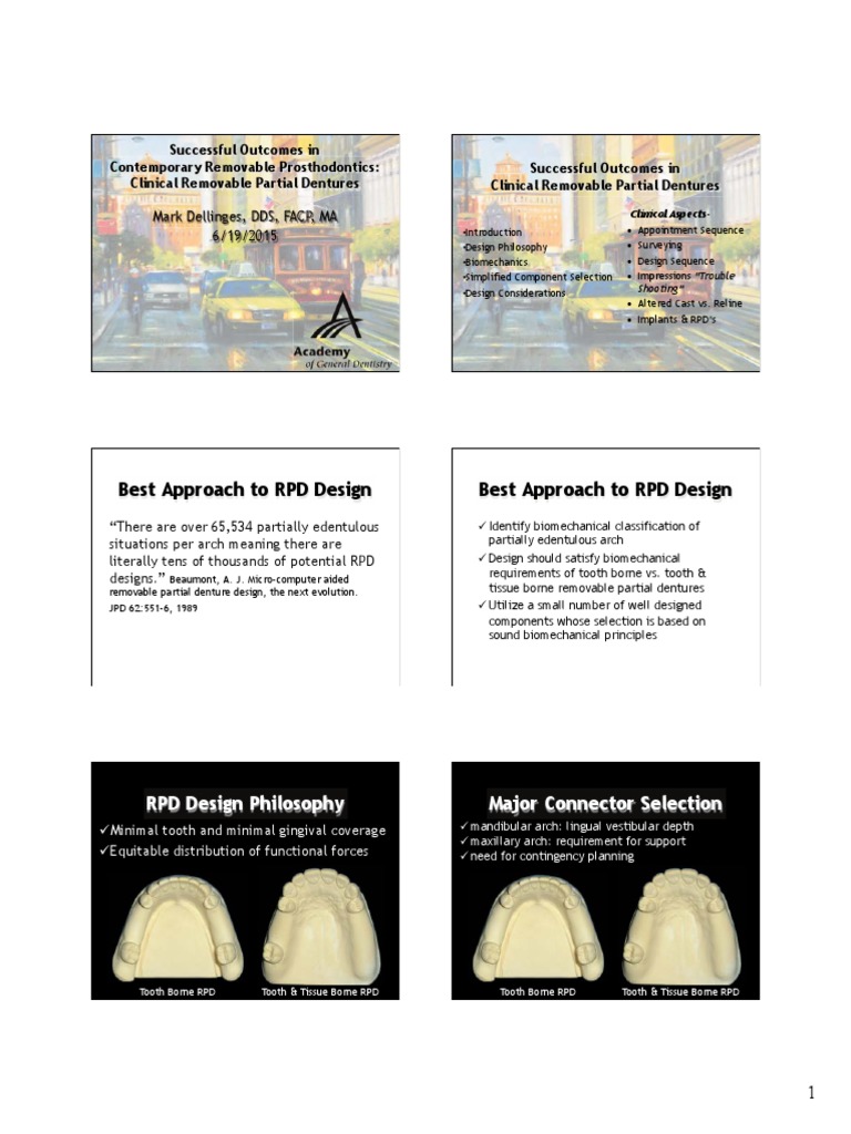 Best Approach To RPD Design Best Approach To RPD Design | PDF ...