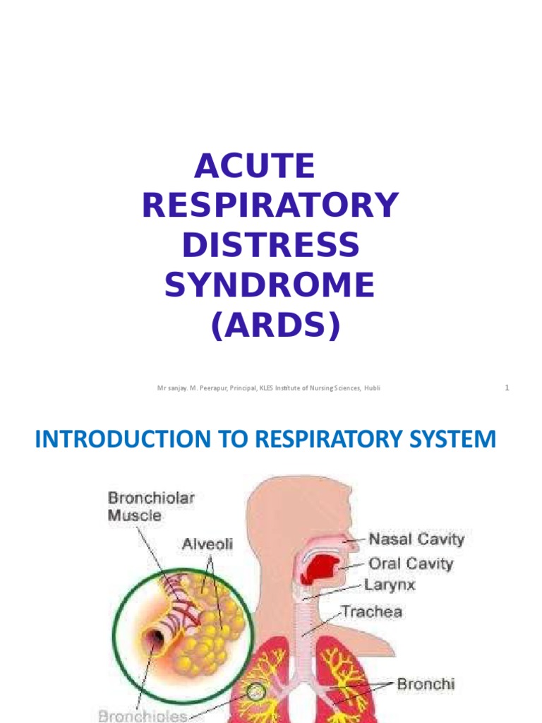 Acute Respiratory Distress Syndrome (ARDS) : MR Sanjay. M. Peerapur ...