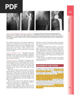 Poster CDC Donning and Doffing PPE 20200305.2p | PDF | Personal ...