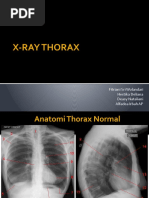 PDF Anatomi Thorax Normal Gambaran Radiologi Compress | PDF