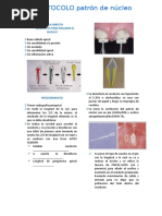 Protocolo para Prótesis Total Removible | PDF | Dentadura postiza | Boca
