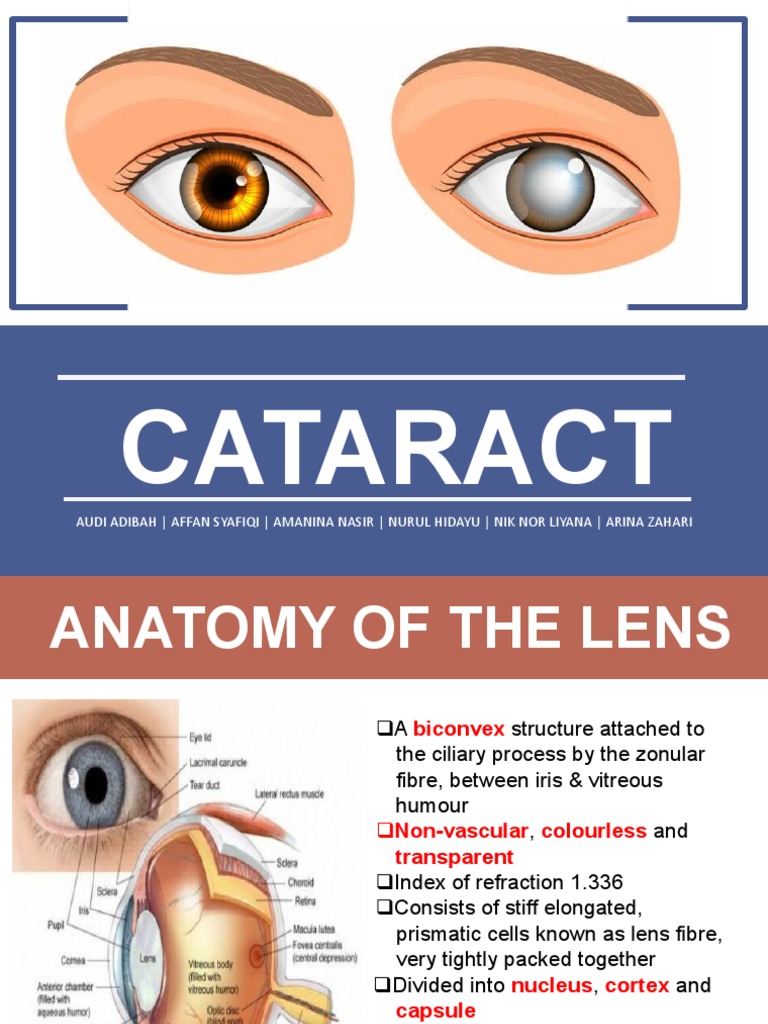 Understanding Cataract Types and Anatomy | PDF | Cataract | Epithelium
