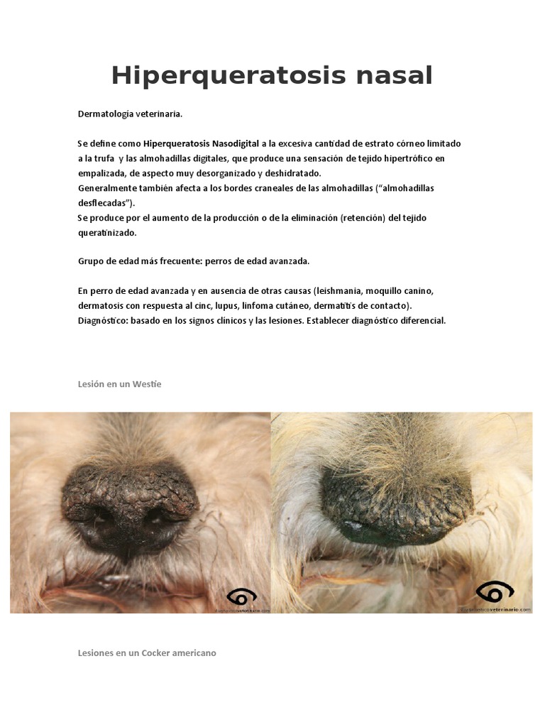 Hiperqueratosis Nasal | PDF