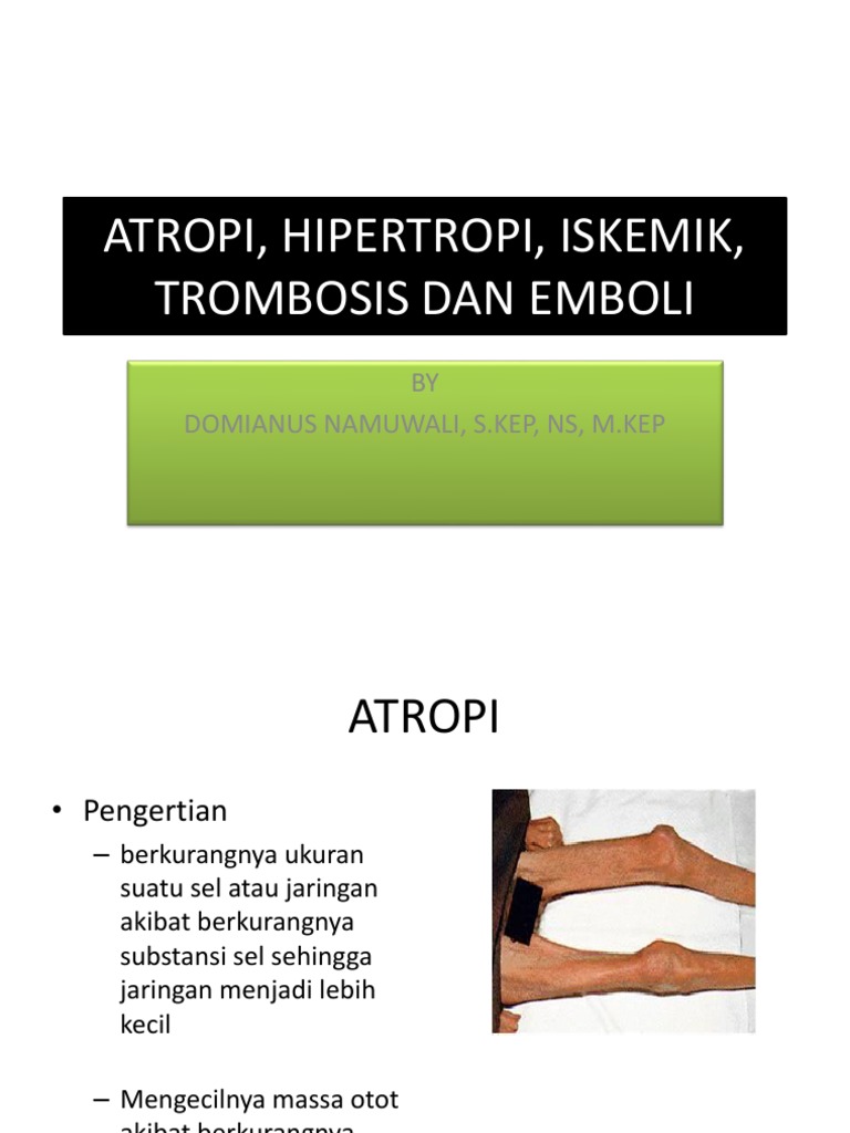 Atropi, Hipertropi, Iskemik, Trombosis 2020 | PDF