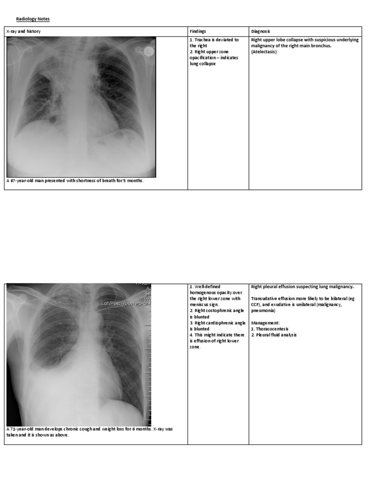 Radiology Notes For OSCE | PDF | Lung | Edema