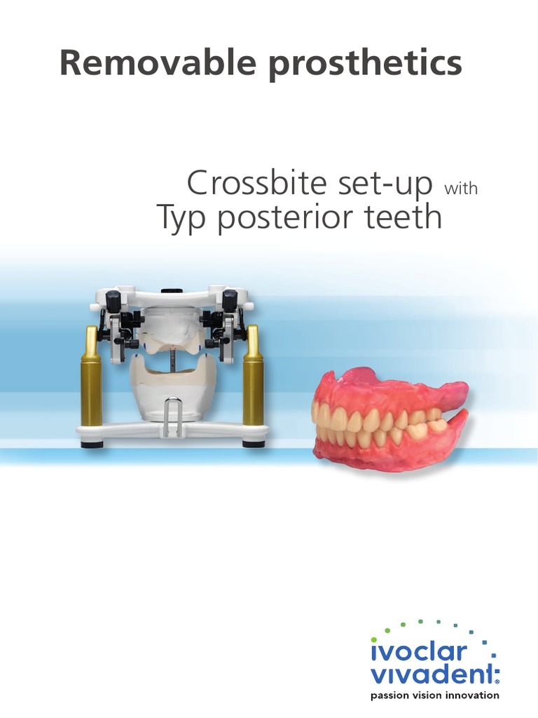 Removable Prosthetics: Crossbite Set-Up Typ Posterior Teeth | PDF ...