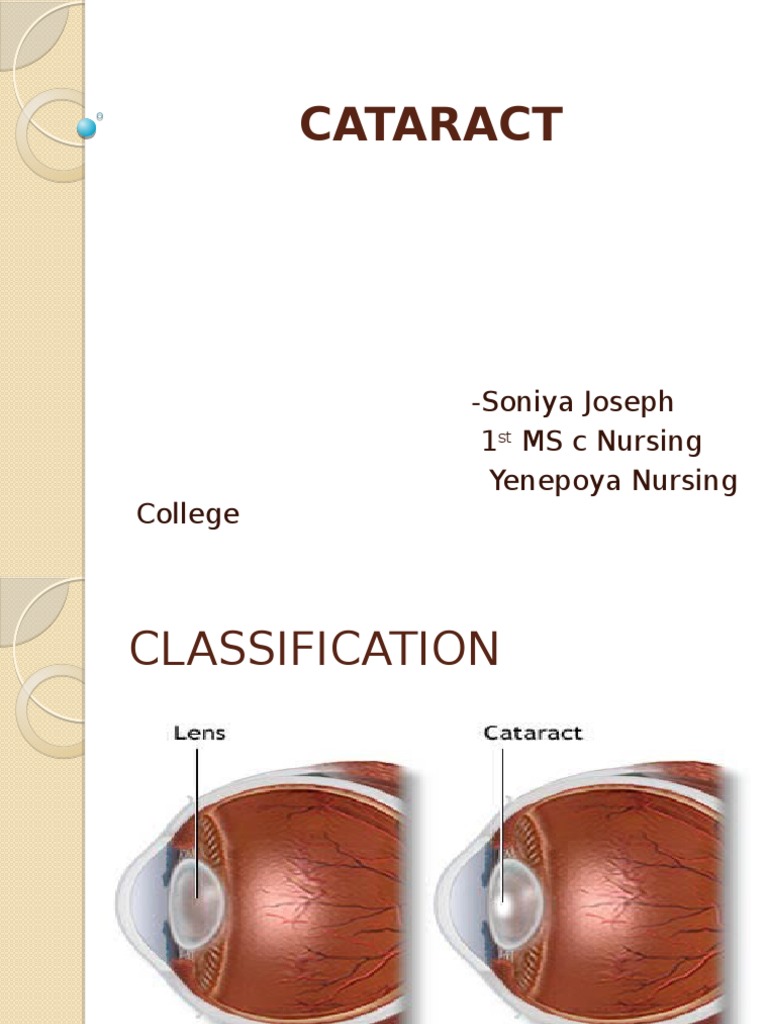 Cataract: - Soniya Joseph 1 MS C Nursing Yenepoya Nursing College | PDF