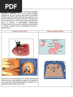 Material de Lectura Operación de Hartmann y Operación de Miles | PDF ...