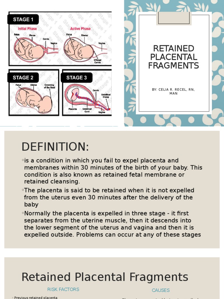 Retained Placental Fragments: By: Celia R. Recel, RN, MAN | PDF ...