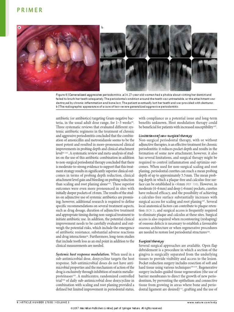 Periodontal 2 | PDF | Periodontology | Human Tooth