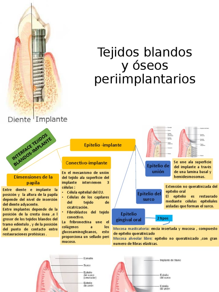 Implantes Dentales | PDF | Epitelio | Anatomía