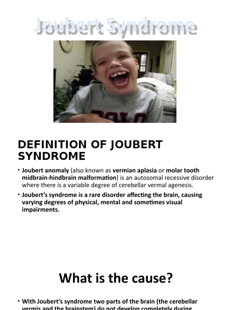 Joubert Syndrome | PDF | Kidney Transplantation | Genetic Disorder