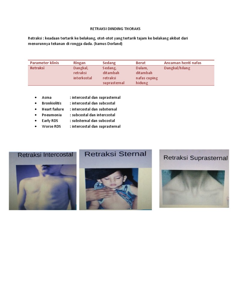 RETRAKSI DINDING THORAKS DR - Joko SP - THT | PDF