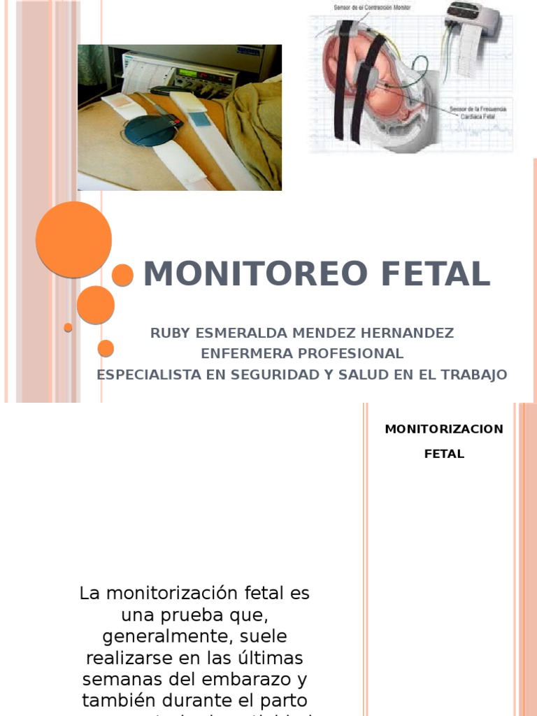 Monitoreo Fetal | PDF | El embarazo | Embarazo Mamífero