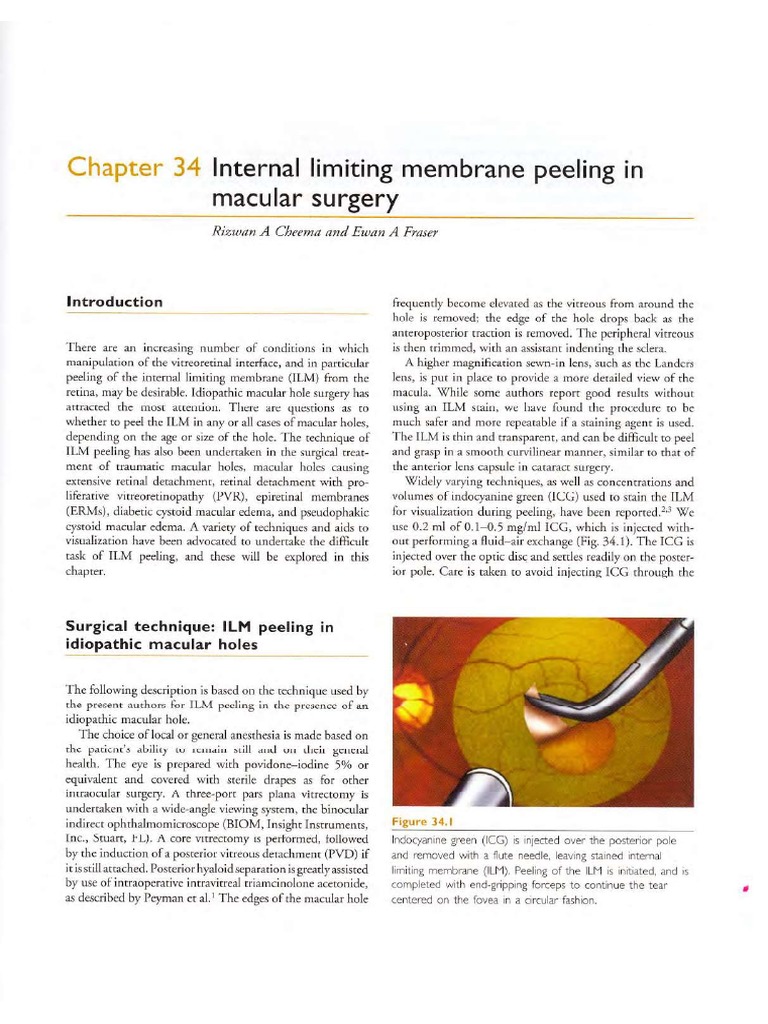 ILM Peeling | PDF