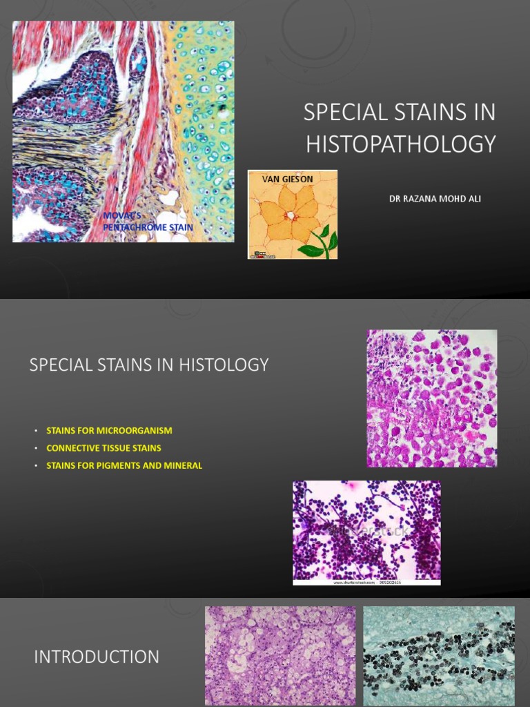 Special Stains in Histopathology: Movat'S Pentachrome Stain | PDF ...