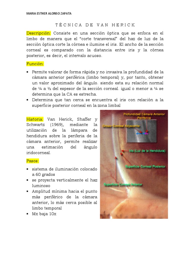TECNICA DE VAN HERICK | Córnea | Óptica