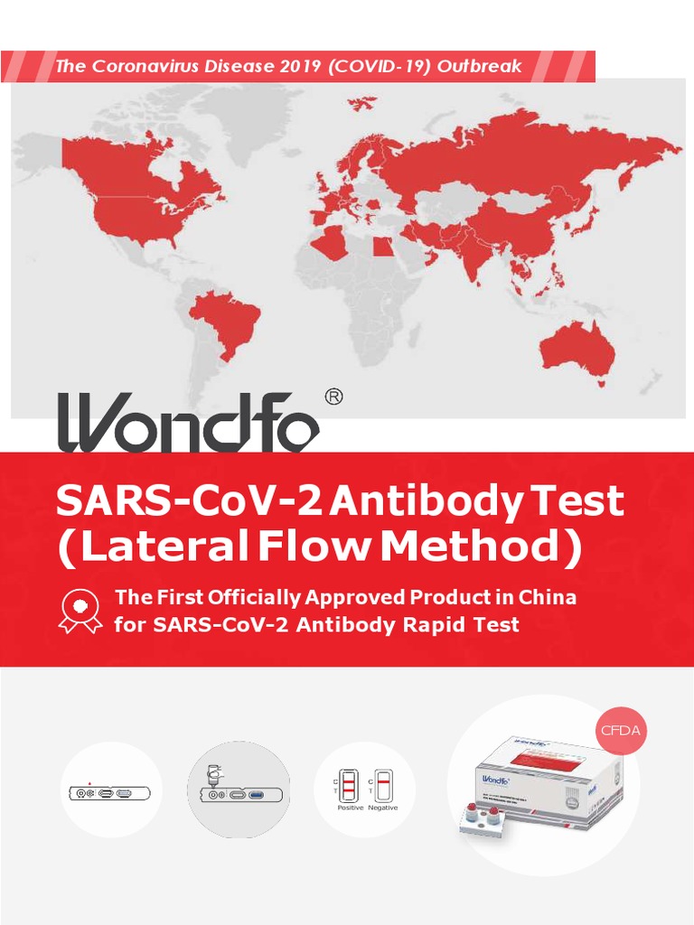 Sars-Cov-2 Antibody Test (Lateral Flow Method) : The Coronavirus ...