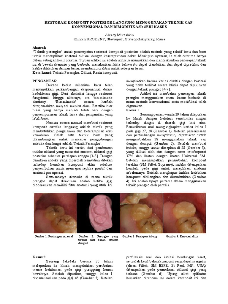 Restorasi Komposit Posterior | PDF
