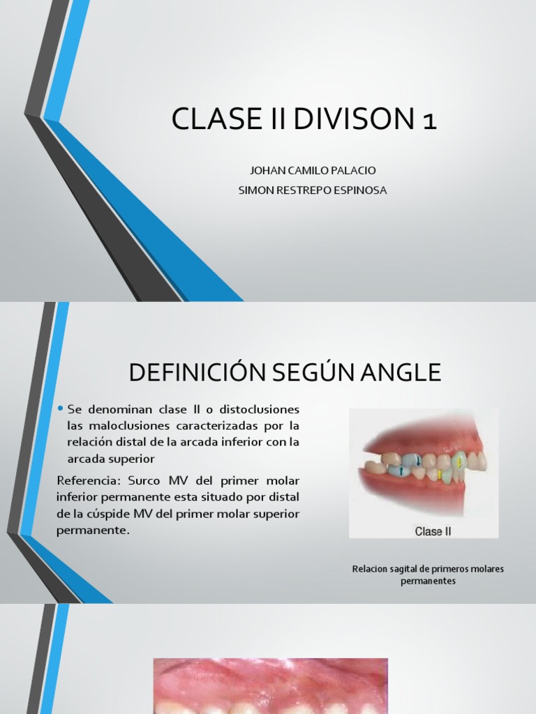 CLASE II DIVISON I Terminado 1 | PDF | Cráneo | Anatomia dental