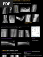 Proyecciones RODILLA RX | PDF | Rodilla | Articulaciones