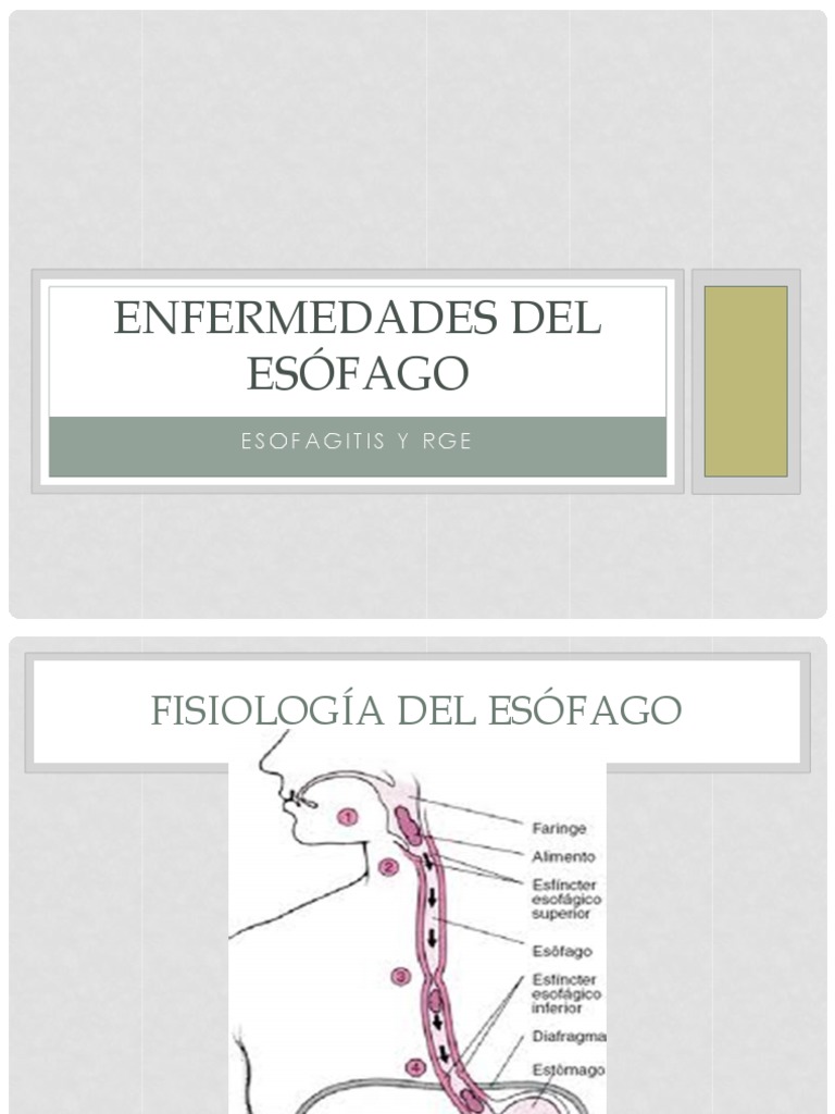 Esófago | PDF | La enfermedad por reflujo gastroesofágico ...