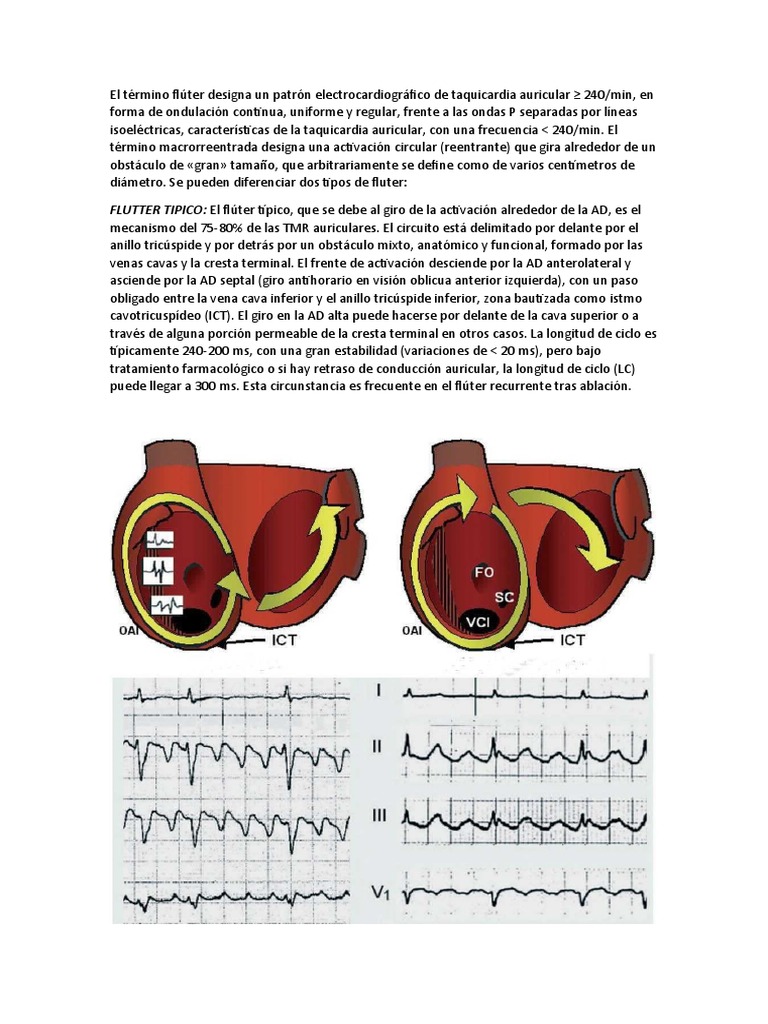 Tipos y Tratamiento del Flutter Auricular | PDF | Electrocardiografia ...