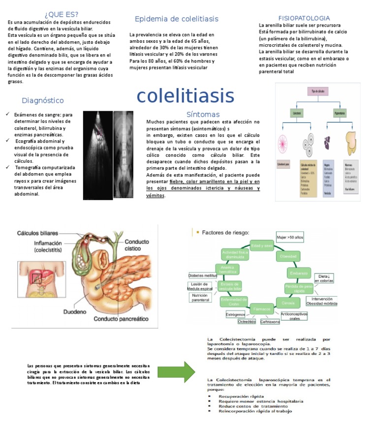 Colelitiasis | PDF | Bilis | Gastroenterología