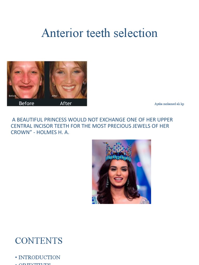 Anterior Teeth Selection | PDF | Tooth | Dentures