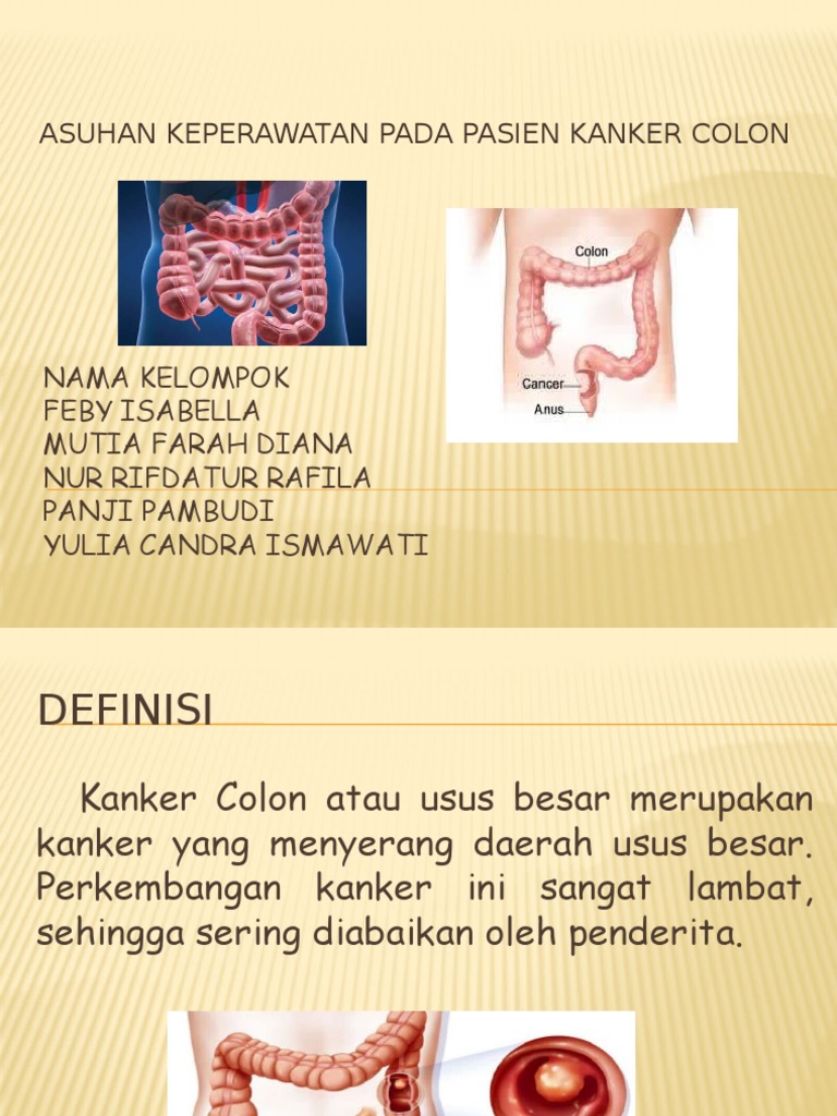 Kanker Colon | PDF