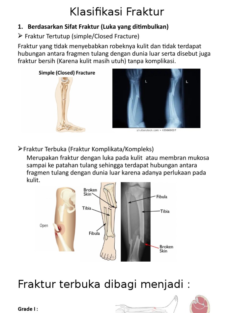 Klasifikasi Fraktur | PDF