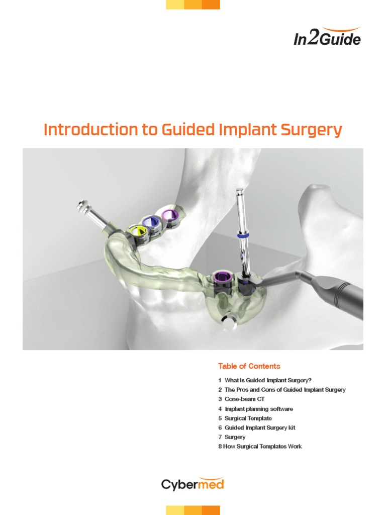 Introduction To Guided Implant Surgery | PDF | Ct Scan | Dental Implant